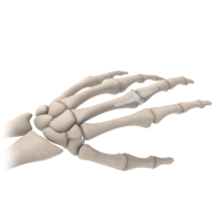 BioPro Implants | Proven Extremity Implant Solutions