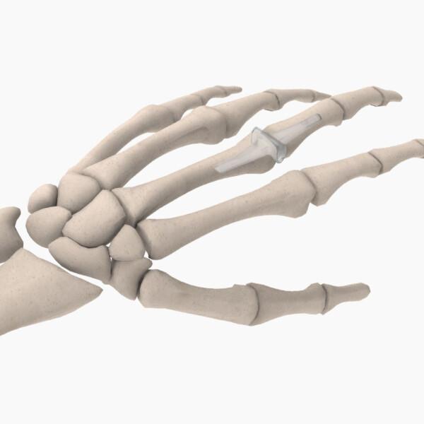 Products - bioproimplants.com