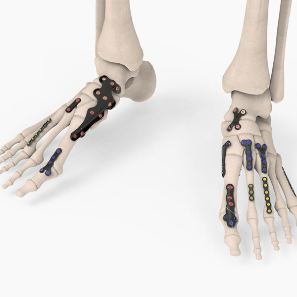 Products - bioproimplants.com