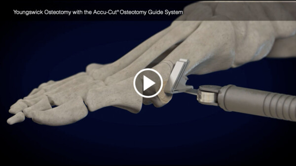 Patient Videos - bioproimplants.com