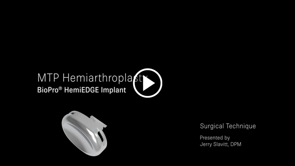 First MPJ Hemiarthroplasty with the First MPJ Hemi Implant ...