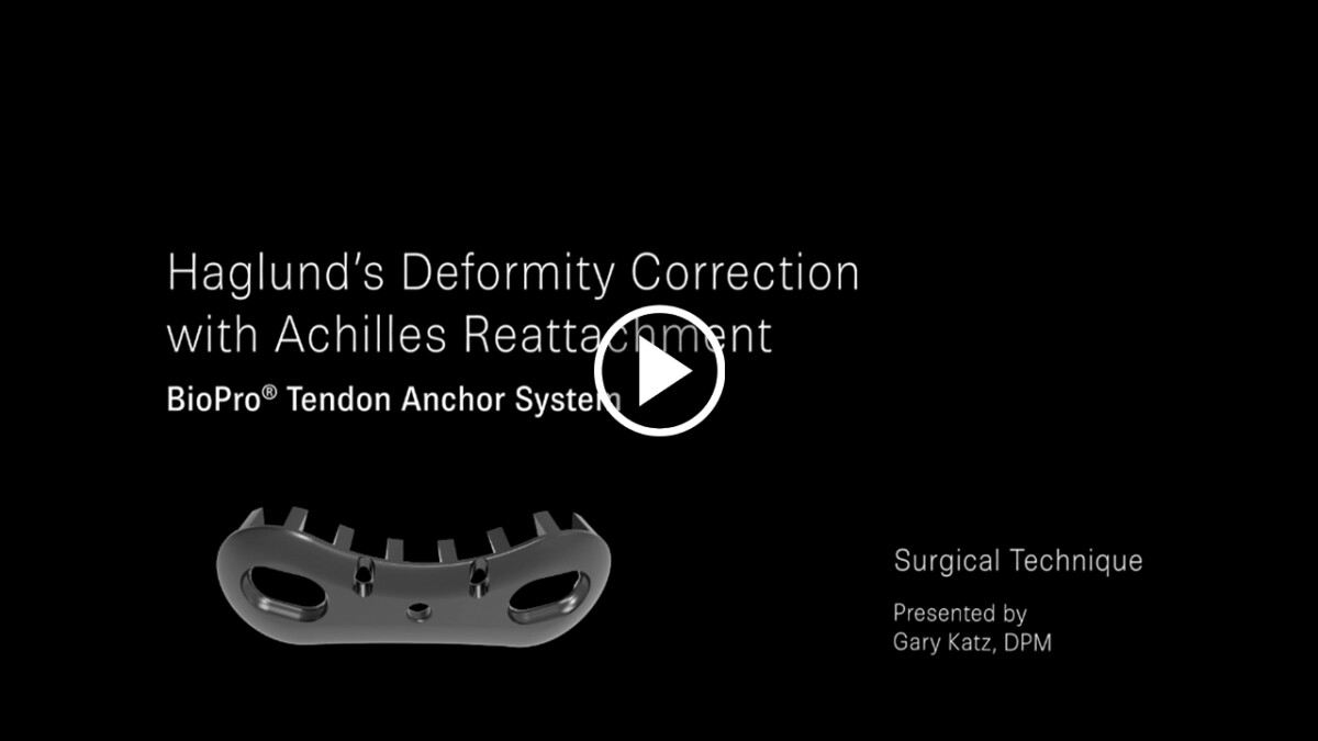 First MPJ Hemiarthroplasty with the First MPJ Hemi Implant ...
