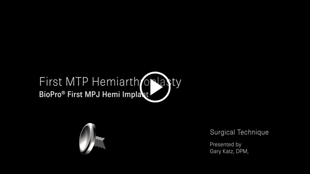 Kidner Procedure with Tendon Anchor System - bioproimplants.com